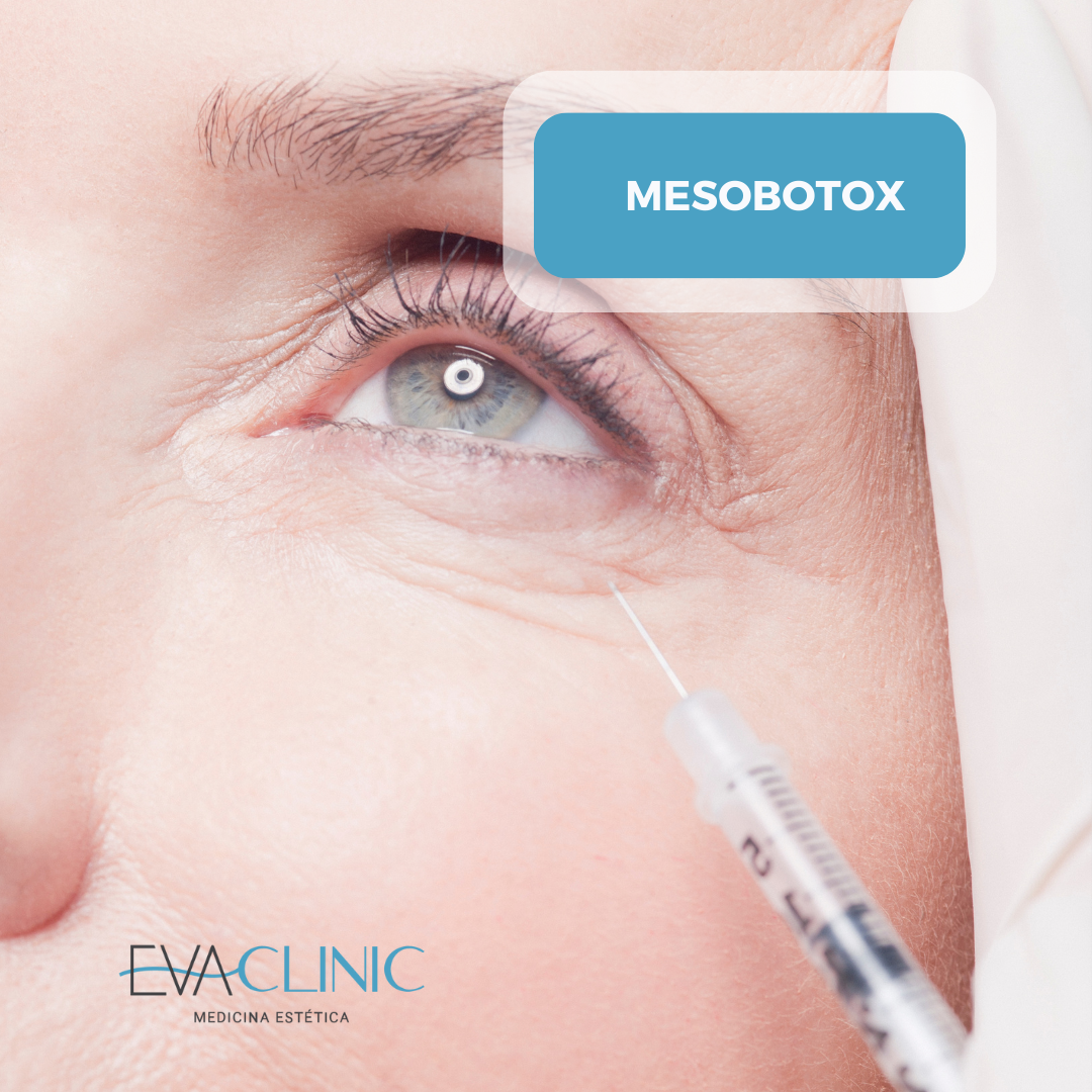 Mesobotox – Evaclinic